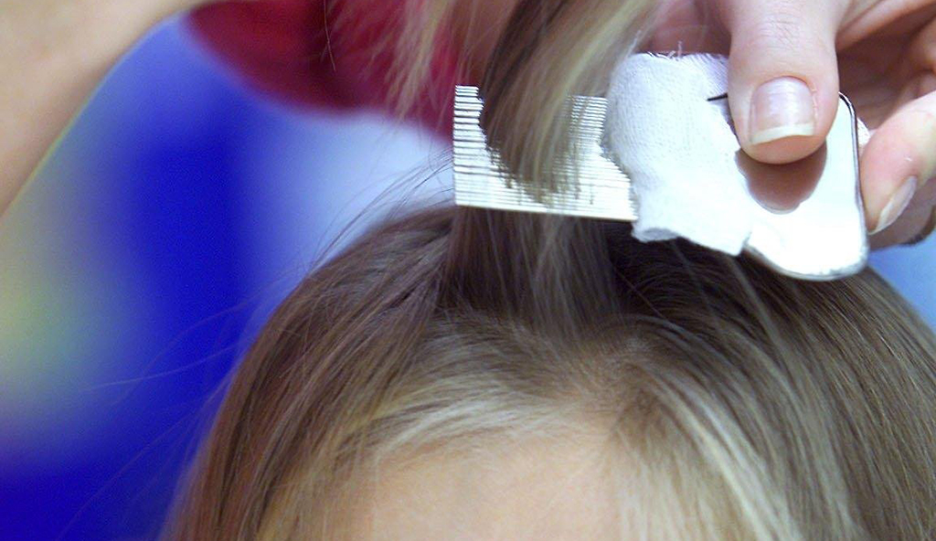 Kriebelfestijn: hoofdluis vooral bij meisjes | RTL Nieuws | RTL.nl