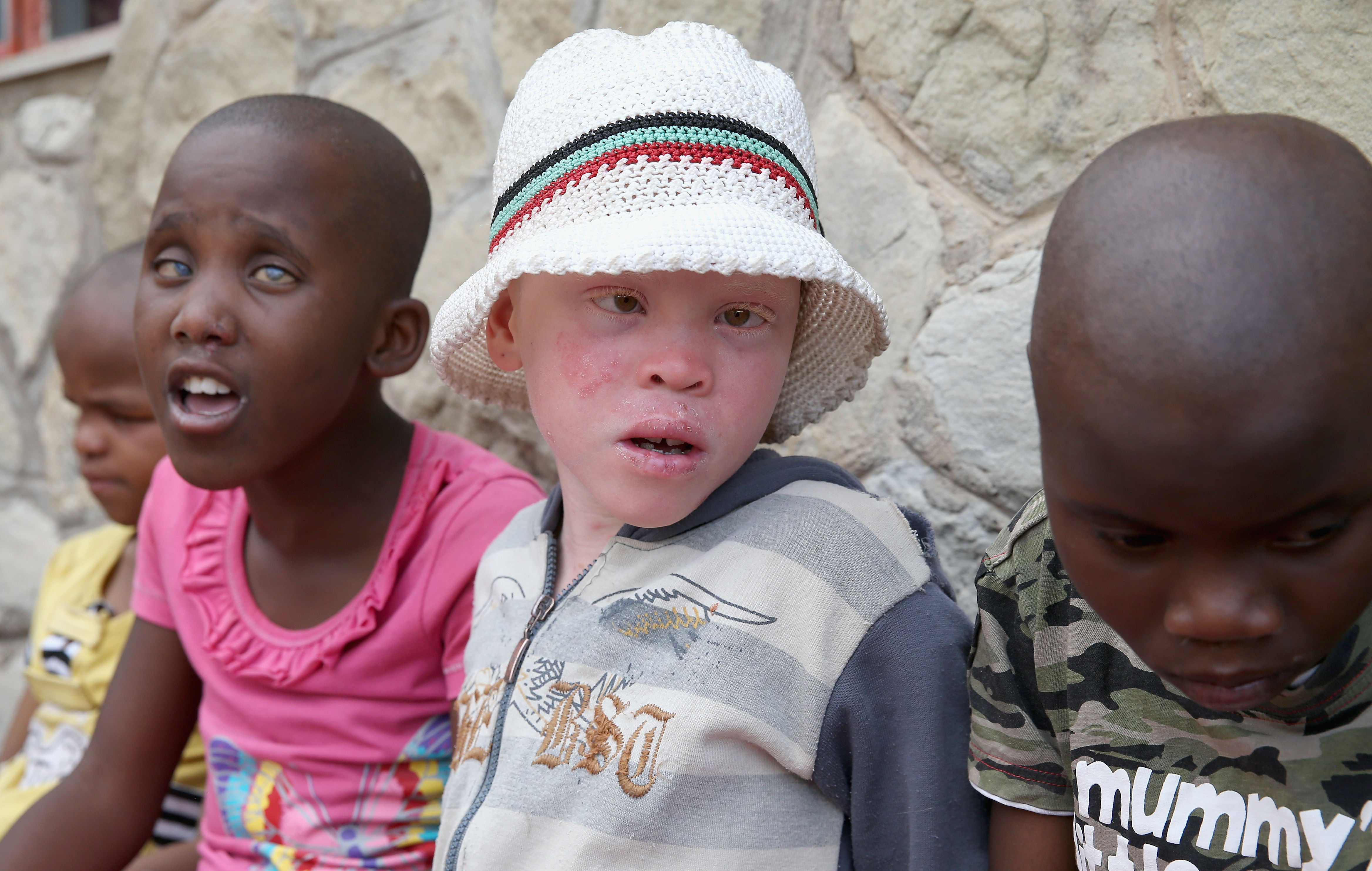 Malawi gaat ontvoerders albino's keihard aanpakken