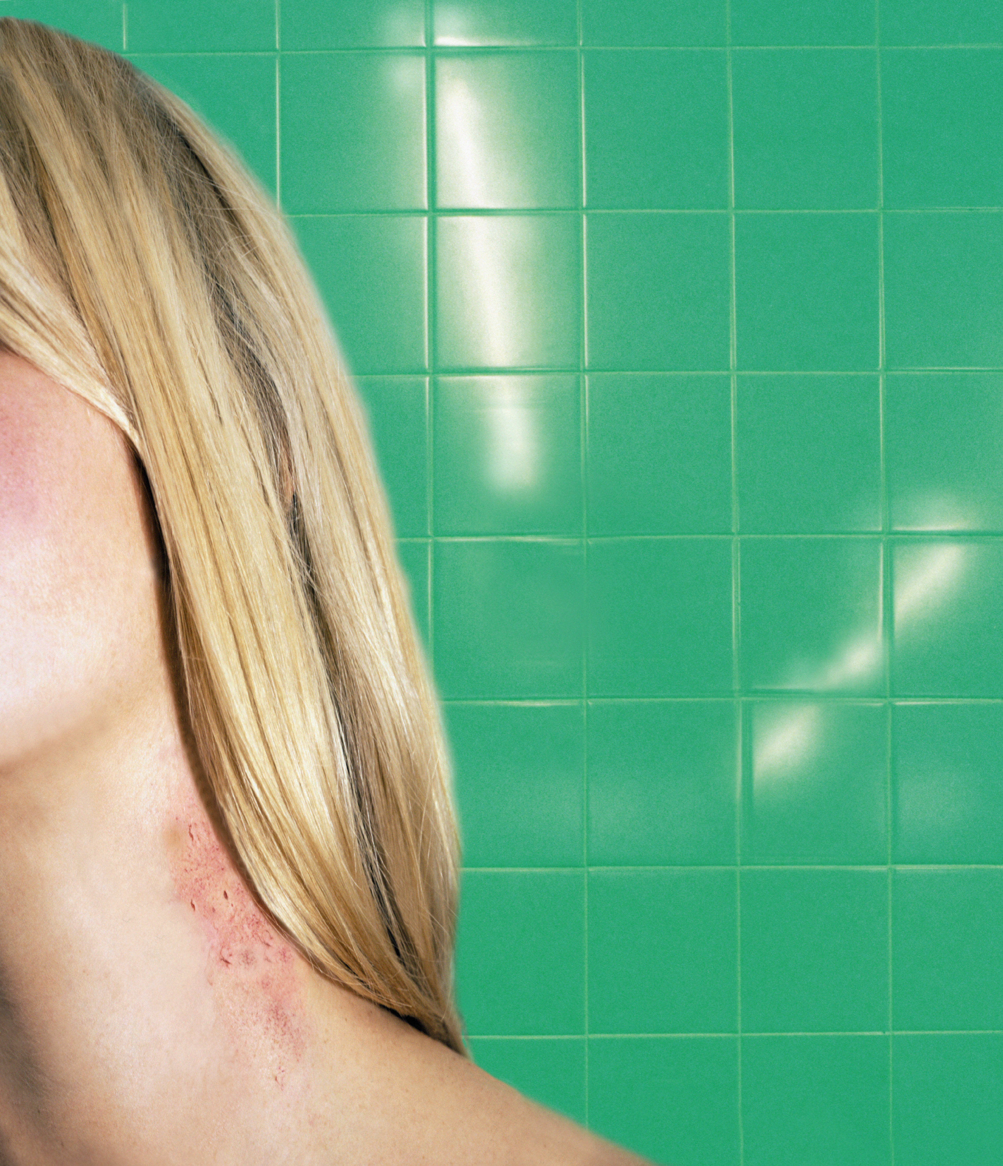 'Mexicaanse tiener overleden na zuigzoen'