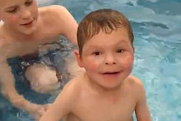 Angus (13) blijft zo groot als een peuter door zeldzame afwijking
