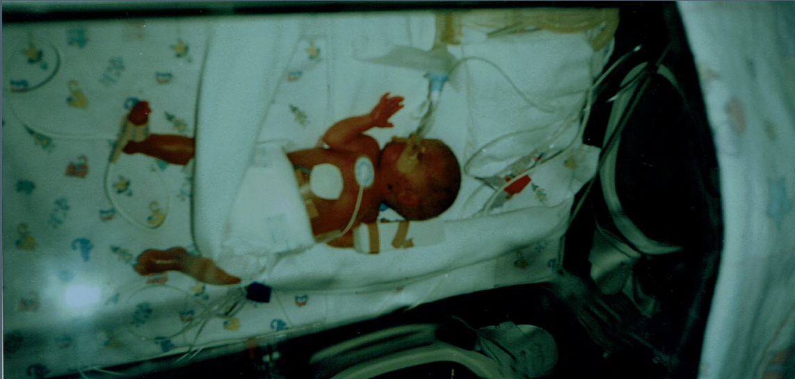 Baby's van 620 gram: 'Het was net een kipfiletje'