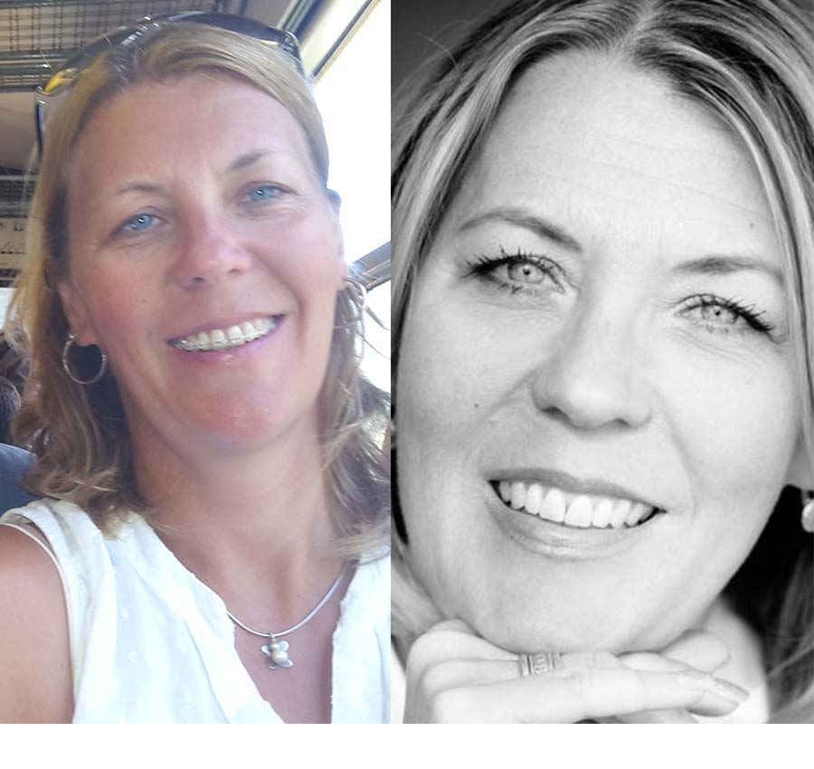 Als je gebit maar goed zit: beugels voor volwassenen