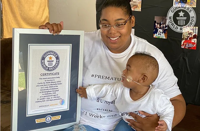 Curtis werd na 21 weken geboren: meest premature baby ooit die het ...