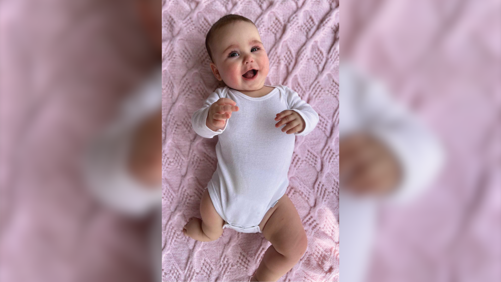 Baby Isa met beenafwijking wint grote fotowedstrijd VS | RTL.nl