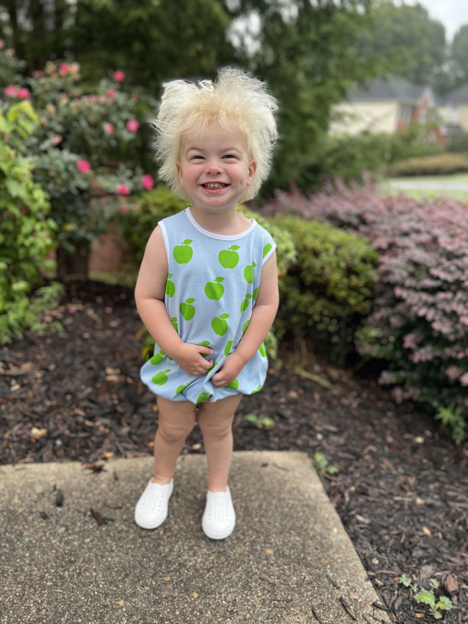 Peuter Locklan heeft het onkambare-haarsyndroom: 'Zelfs huisartsen ...