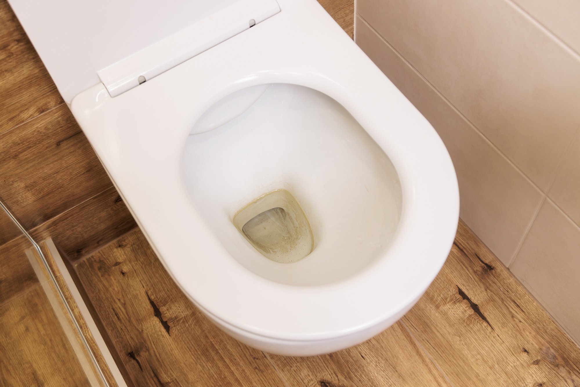 Urinesteen in het toilet: zo ontstaat het en zó verwijder je het