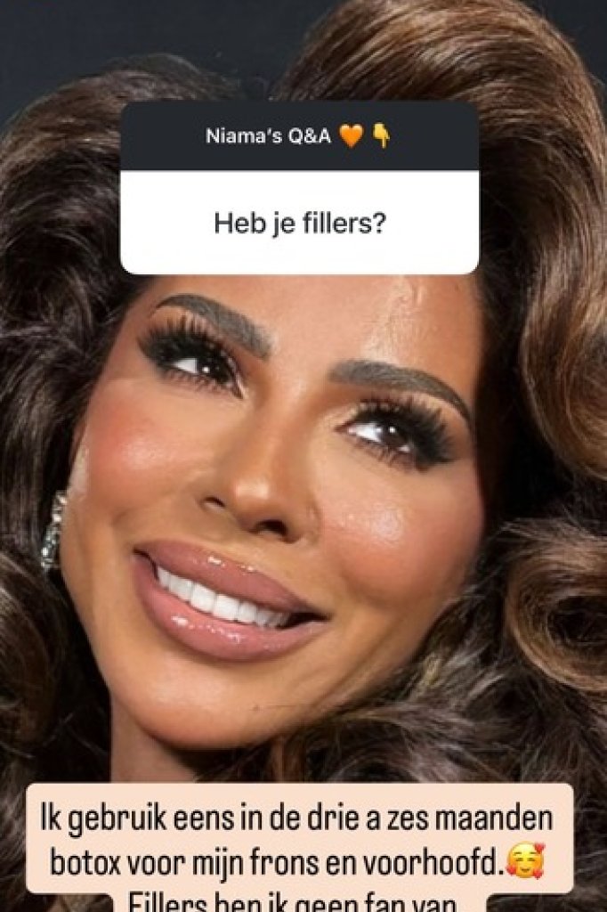 Niama Amhali doet boekje open over cosmetische ingrepen en trekt een ...